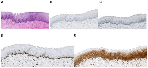 Normal Vulvar Tissue Histology And Ihc A Histological Appearance