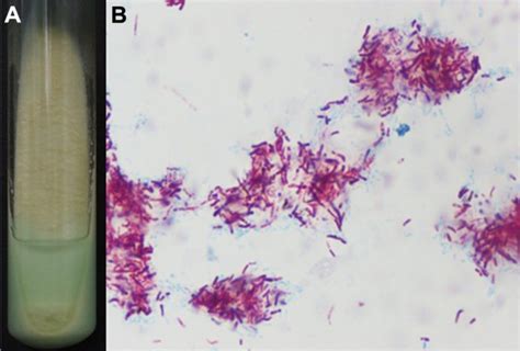 Pathogenic Organism A Mycobacterial Cultures From The Isolated