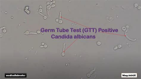 germ tube test introduction principle procedure result