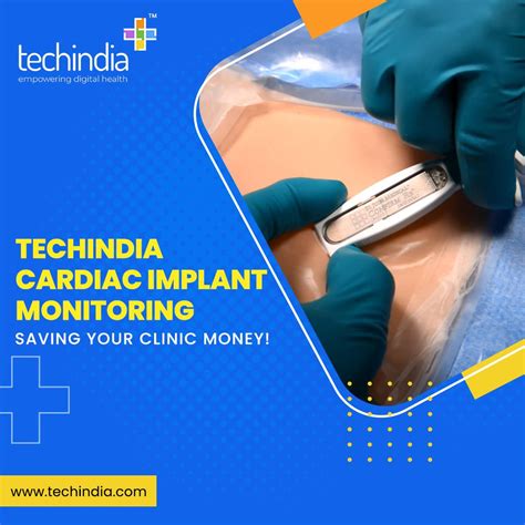 Techindia Infoway Pvt Ltd On Linkedin Forget Costly Upfront