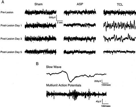 Synchronous Neuronal Activity Is A Signal For Axonal Sprouting After