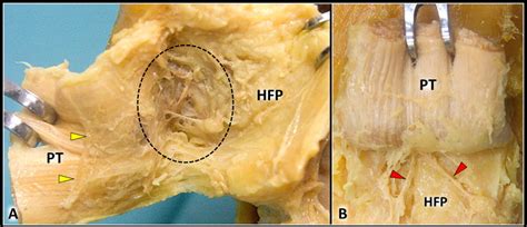 Patellar Tendonhoffa Fat Pad Interface From Anatomy To High