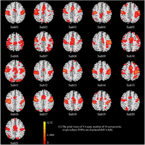 Test Retest Reliability Of Peak Location In The Sensorimotor Network Of