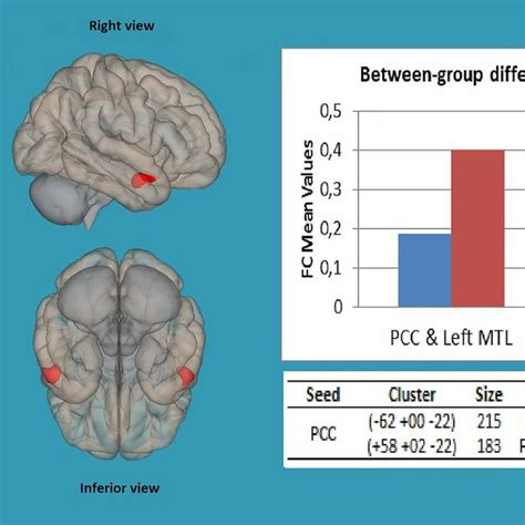 Between Groups Differences In Resting State Fc Between The Regions Of