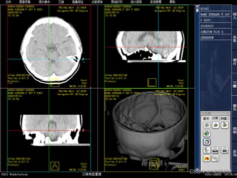 C 医学影像pacs系统源码，影像归档和通信系统全套源码 Pacs C 源码下载 Csdn博客