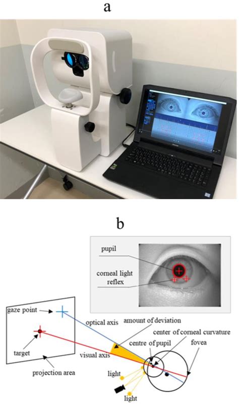 Figure 1 From Objective Measurement Of Nine Gaze Directions Using An Eye Tracking Device