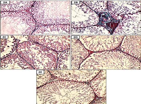Micrographs Of Testicular Tissue Stained With Masson Trichrome Reveal Download Scientific