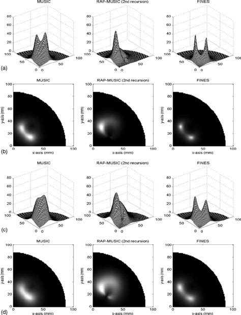2D Mesh Plots And Images At Z 20 Mm Of The Three Algorithms For Download Scientific Diagram