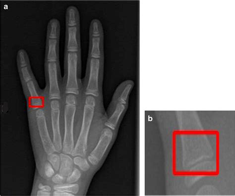 A An Example Of A False Positive Prediction Made By The Algorithm Red