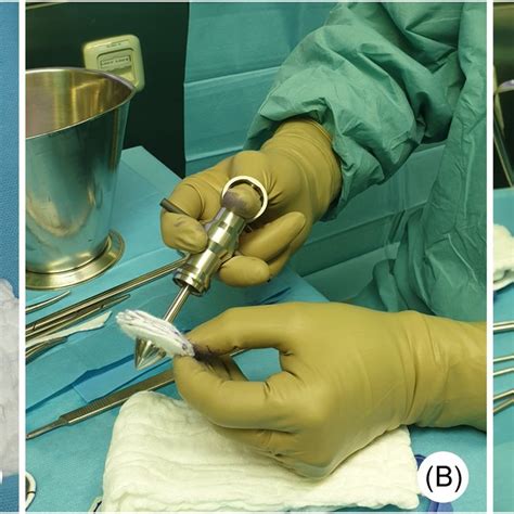 Right Atriotomy Closure With Modified Ventricular Assist Device Ring