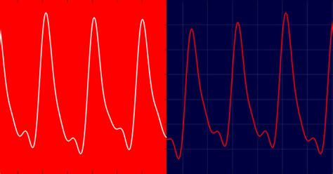 What Is Photoplethysmography Ppg Curious Cyborg