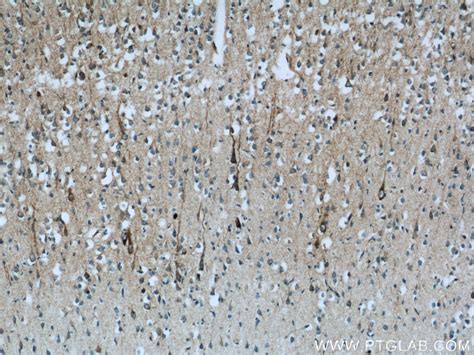 Ndufb7 Antibody 14912 1 Ap Proteintech
