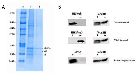 Histone Extraction Kit The Preserves Post Translational Modifications
