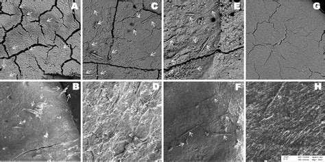 Scanning Electron Micrographs Of Fibroblasts A C E G And