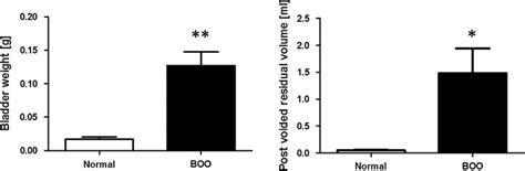 Comparison Of Bladder Weight Or Post Voided Residual Urine Volume