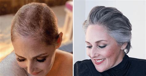 Ricki Lake Flaunts Her One Year Hair Transformation With Before And