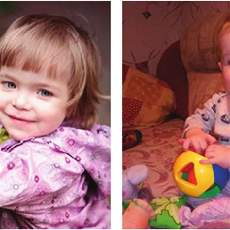 Pdf First Experience Of Hematopoietic Stem Cell Transplantation Treatment Of Shwachman Diamond