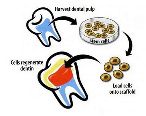 Stem Cell A Dynamic Future Of Dentistry Dentalimplantindia