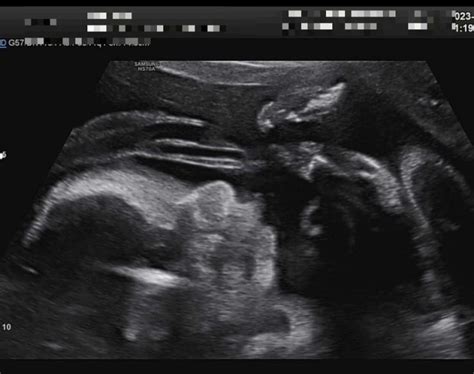 임신기록임신24주차 임신25주차 임신26주차 임신27주차 임신28주차부터 임신 29주차까지 증상검사 등 네이버 블로그