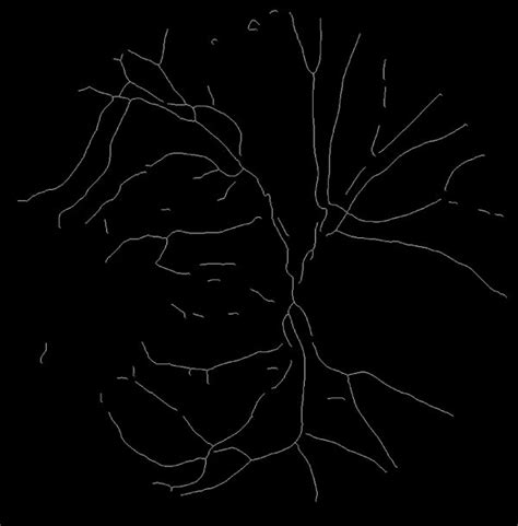 cropped retinal image a and the corresponding skeletonized image b