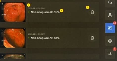 아이도트 인공지능 위내시경 솔루션 식약처 3등급 인허가 획득