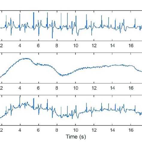 Experimental Signals A Abnormal Ecg From The Mit Bih Database