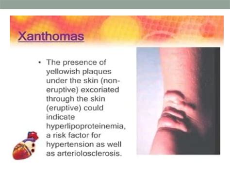 Cardiovascular Assessment For Nurses Pptx
