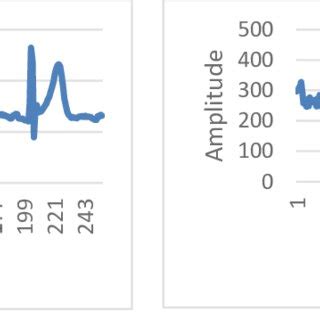 Graph The Typical ECG Signal From Two Participants Download Scientific Diagram
