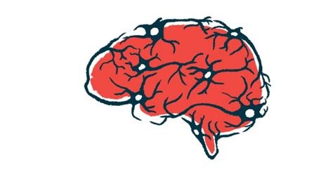 Targeting Reactive Astrocytes In Brain May Lead To Novel Treatments R Youngparkinson