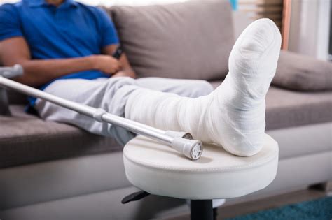 Marina Del Rey Foot Stress Fractures Doctor Socal Sports Podiatry