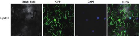Subcellular Localization Of Lpnes1 In N Benthamiana Confocal Image Of Download Scientific