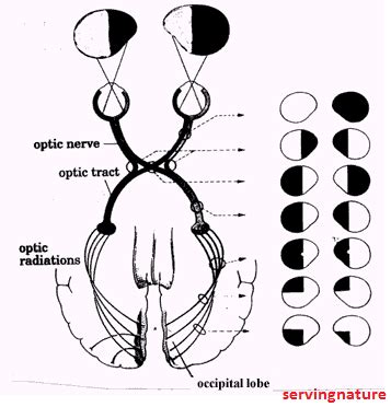 Healthy Body Healthy Mind Visual Field Determination