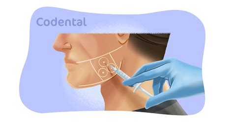 Placa Bacteriana O Que é Prevenção E Tratamento