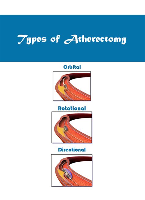 Atherectomy Vascular Institute