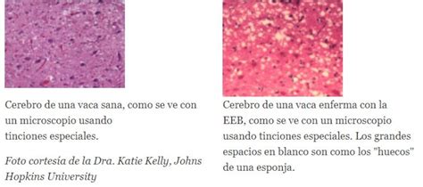 Qué Es El Mal De La Vaca Loca Y Cómo Puede Afectar A Los Humanos Infobae