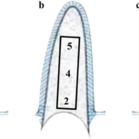 Measurement Points Of The Extraction Socket A Buccal 1mesial Papilla Download Scientific