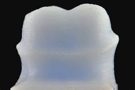 Resin Die Figure 4 Stone Die With Die Spacer Download Scientific