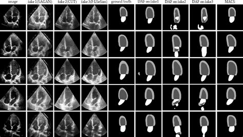 Figure 6 From Cross Domain Echocardiography Segmentation With Multi Space Joint Adaptation