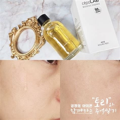 셀프 건성피부관리 세리포리아에센스 속보습관리 서두르세요 네이버 블로그