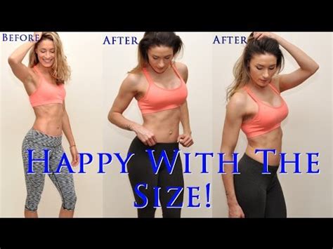 Progress Update Post Breast Augmentation Second Post Op Visit Part 4