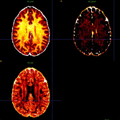 Noddi Outputs From Amico Quality Check