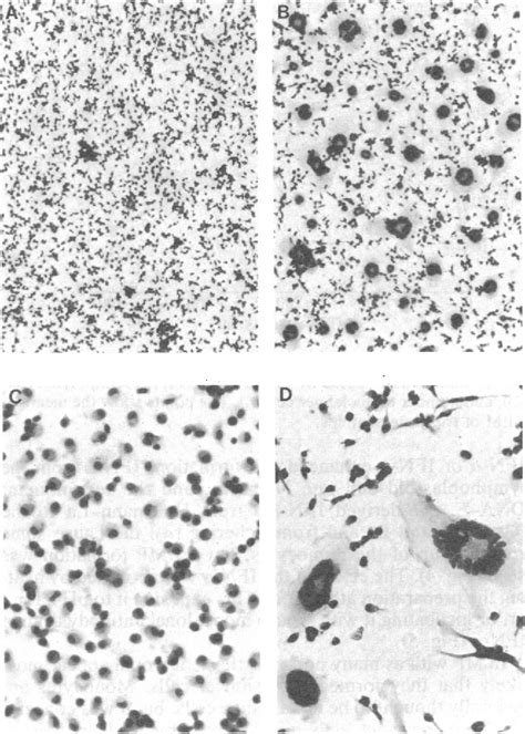 Figure 1 From Recombinant Human Y Interferon Induces Human Monocyte Polykaryon Formation