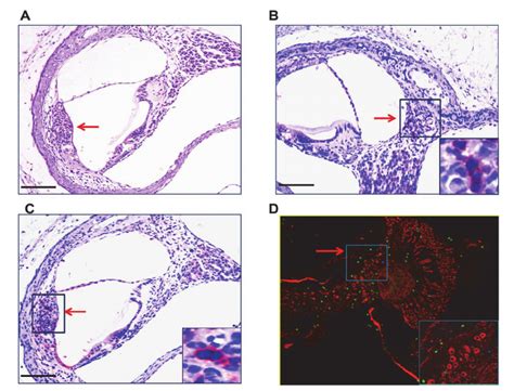 Mononuclear Cells Infiltrates In The Cochlea Of Infected Mice A