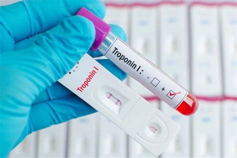 Тропониновый тест при инфаркте миокарда: что это такое, норма в анализе ...