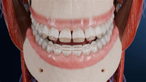 Systemic Enamel Hypoplasia Causes Classification And Treatment