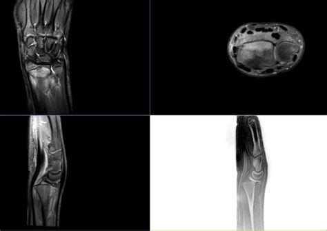 Mohammed Kamal On Linkedin Bone Window Mri Zte Ge Bone Msk