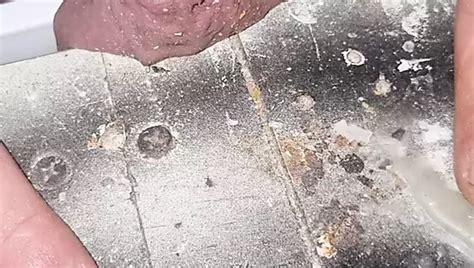 Foreskin Strechter Hot Wax Ball Press And Tens Xhamster