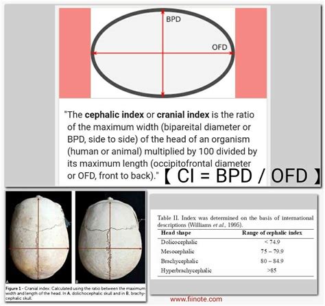 Cephalic Index Biparietal Diameter Occipitofrontal Diameter