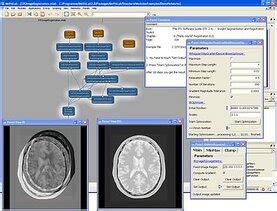MeVisLab ITK And VTK Integration
