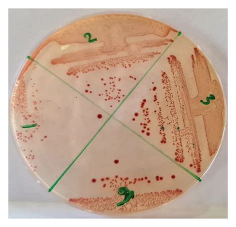 A Red Colonies Of A Baumannii On Chromagar™ Acinetobacter Agar B